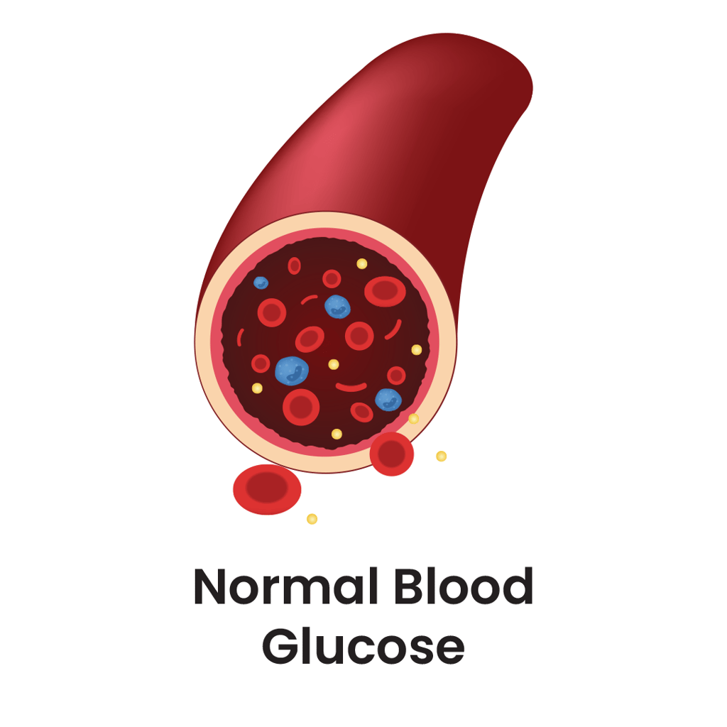 Diabetes - The Perfect Workout®